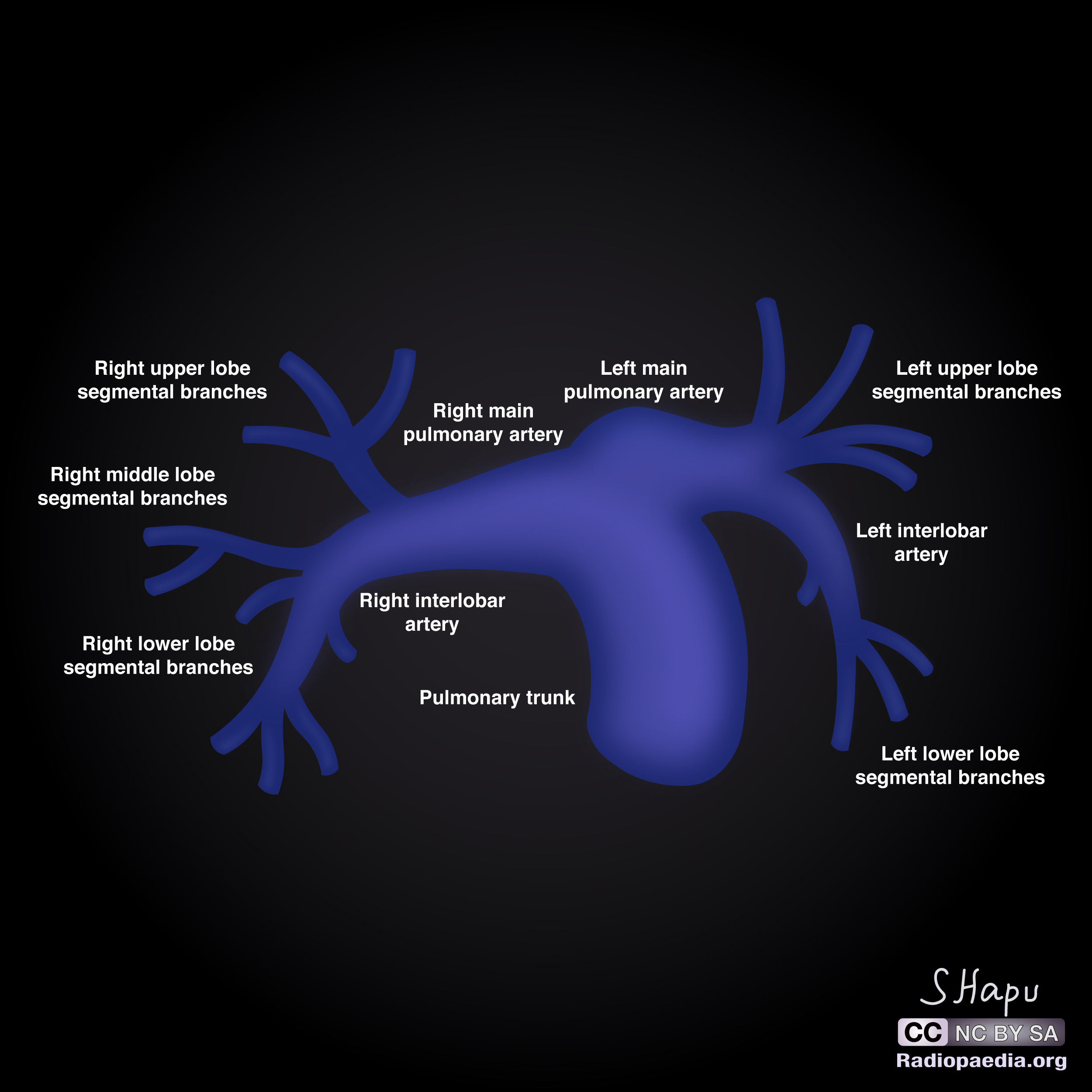 Radiopaedia - Drawing Pulmonary trunk and its branches - English labels ... Radiopaedia - Drawing Pulmonary trunk and its branches - English labels ...
